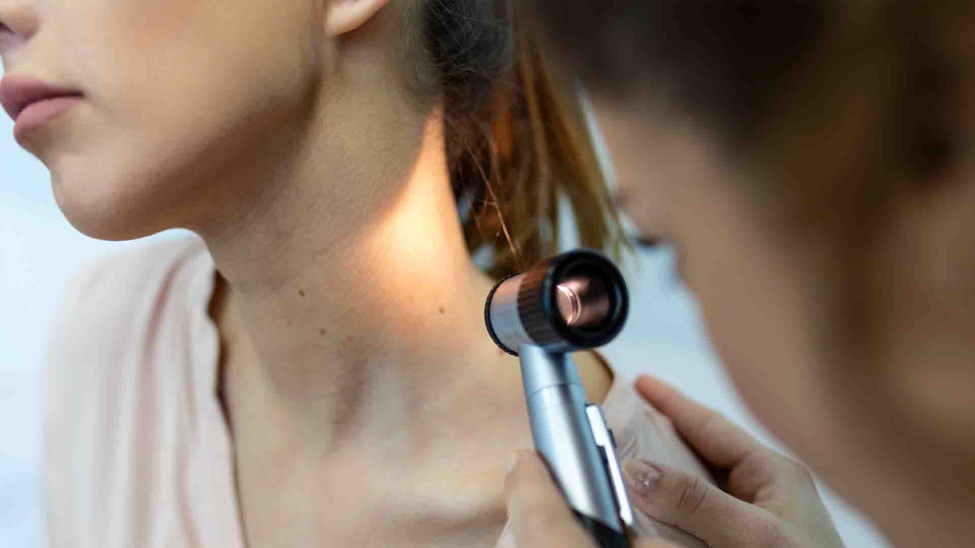 Transmission et symptômes de la gale