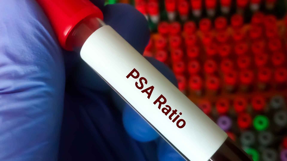 Hypertrophie prostatique : symptômes, causes et traitement