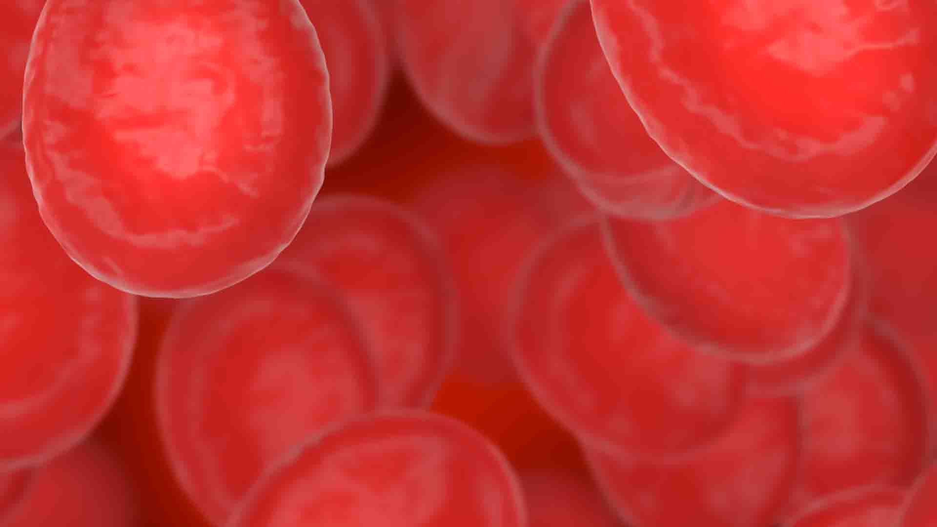 Les causes de l'ictère chez l'adulte et le nouveau-né